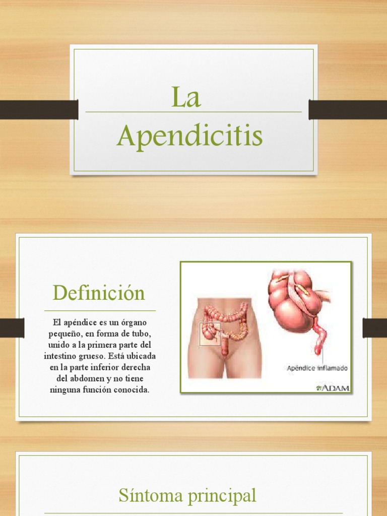 La apendicitis | PDF