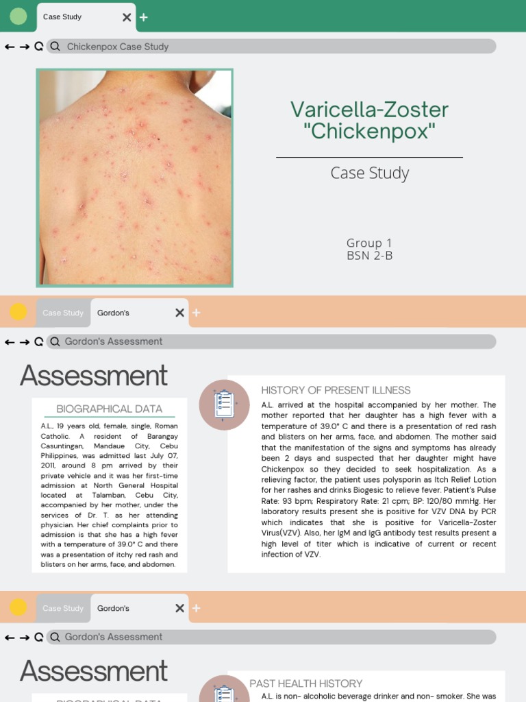 Chickenpox Case Study: A Case Report on a 19-Year-Old Female with ...