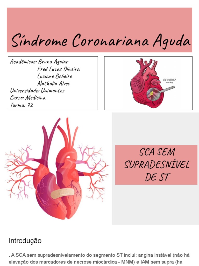 Síndrome Coronariana Aguda: Diagnóstico e Tratamento | PDF | Infarto do ...