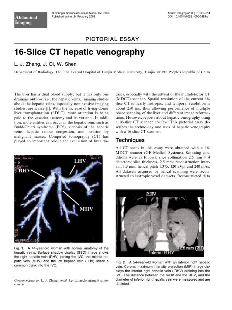 16-Slice CT Hepatic Venography: Pictorial Essay | PDF | Liver | Vein