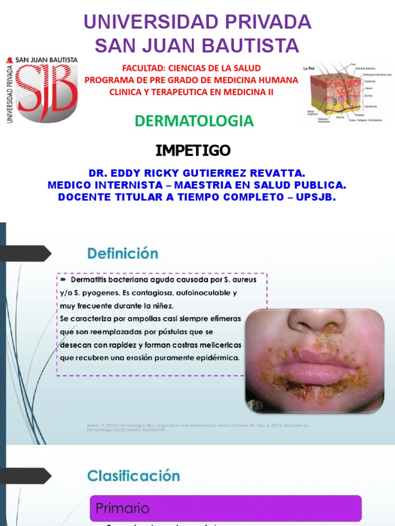 Impetigo Upsjb | PDF