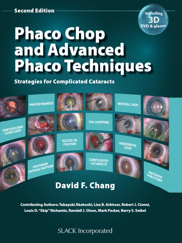 Phaco Chop and Advanced Phaco Techniques Strategies For Complicated Cataracts (David F. Chang ...