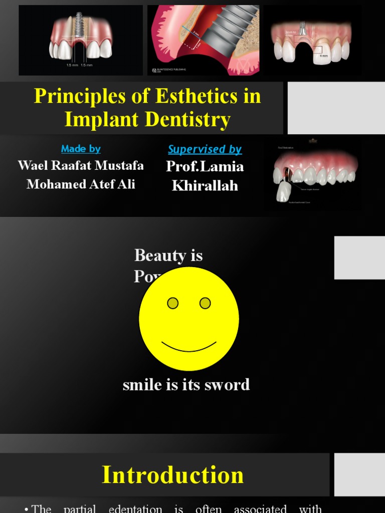 Esthetic Principle in Implant | PDF | Dental Implant | Periodontology