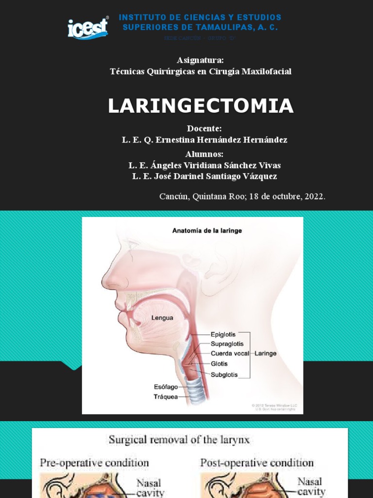 Laringectomia Técnica Quirúrgica | PDF | Laringe | Cáncer