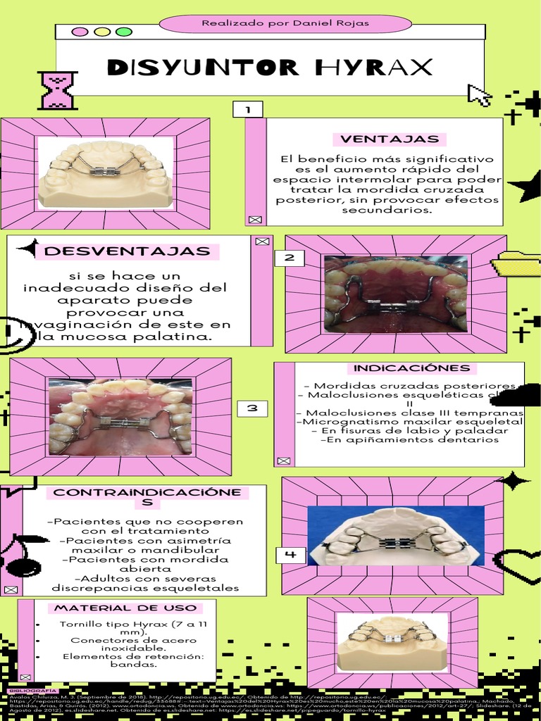 Infografía Disyuntor Hyrax | PDF | Boca | Rasgos faciales