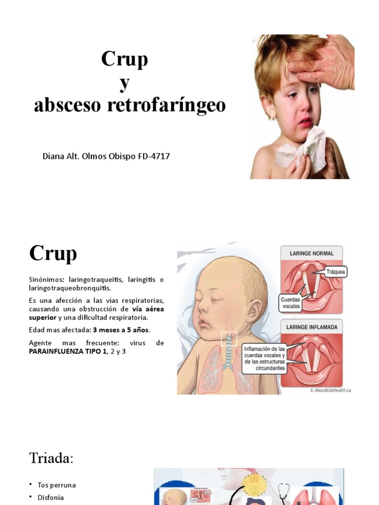 Crup y absceso retrofaríngeo en niños | PDF | Enfermedades y trastornos ...