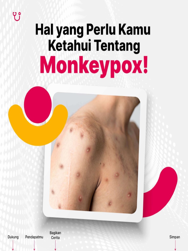 Informasi Monkeypox - Halodoc | PDF