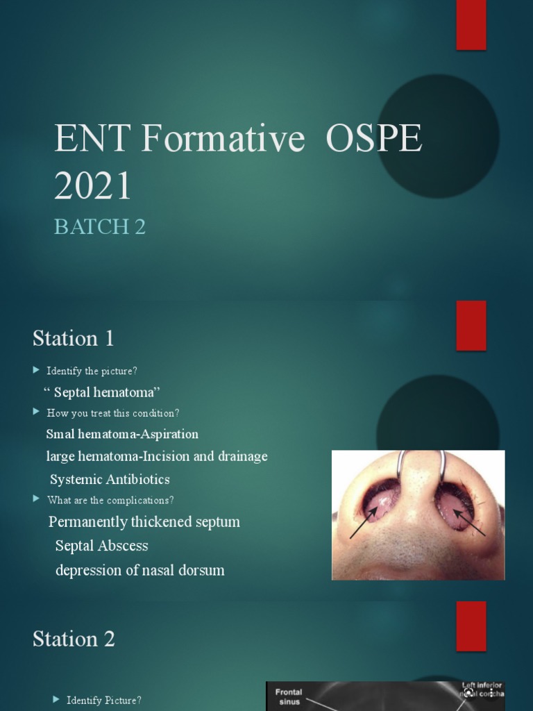 ENT OSPE Guide for Medical Students | PDF