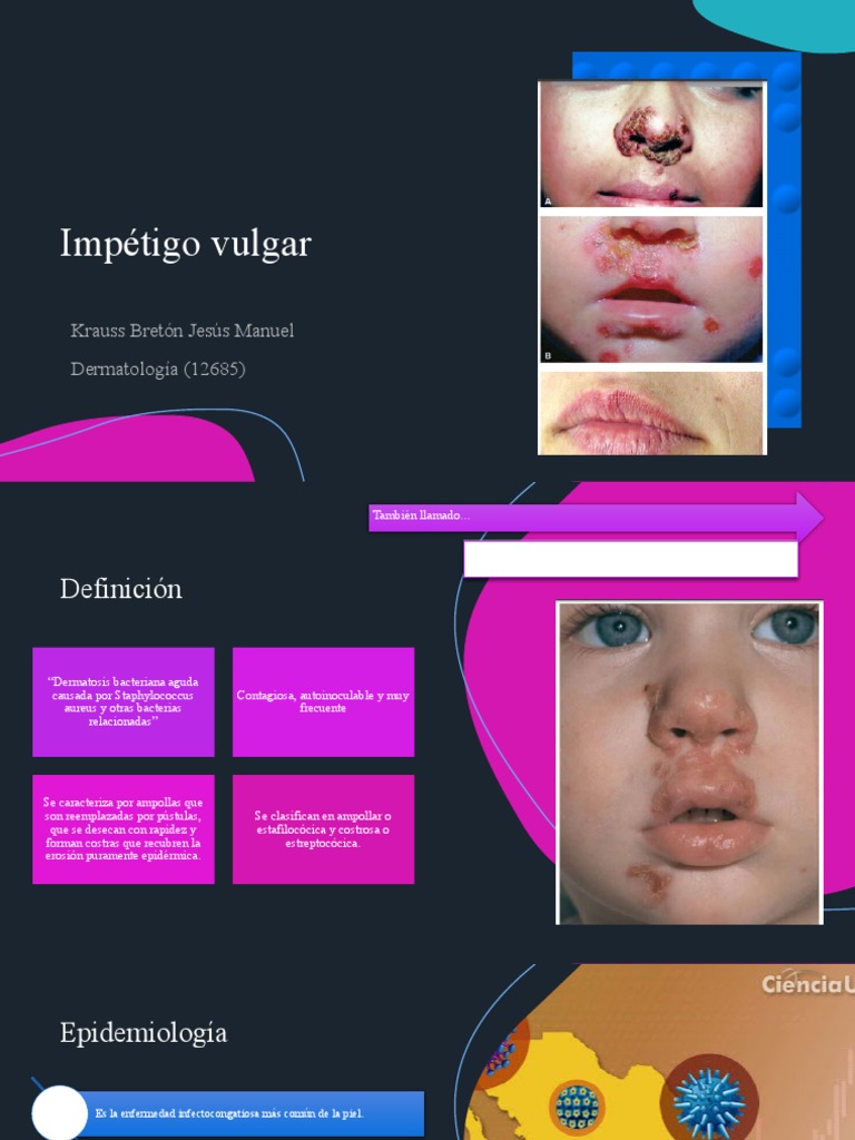 Impétigo, Forinculitis y Forunculosis - 1era Clase de Derma | PDF ...