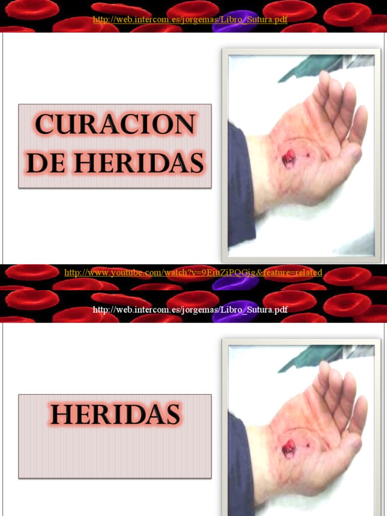 6 Curacion de Heridas y Suturas | PDF | Herida | Curación