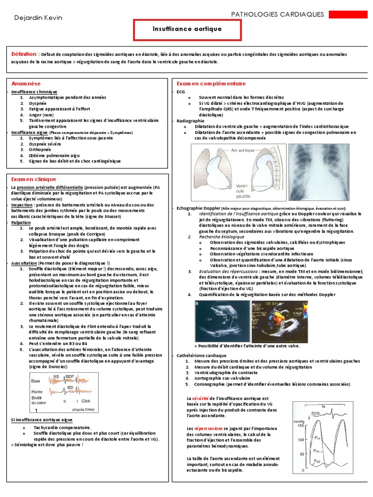 Insuffisance Aortique : Diagnostic et Traitement | PDF | Insuffisance ...