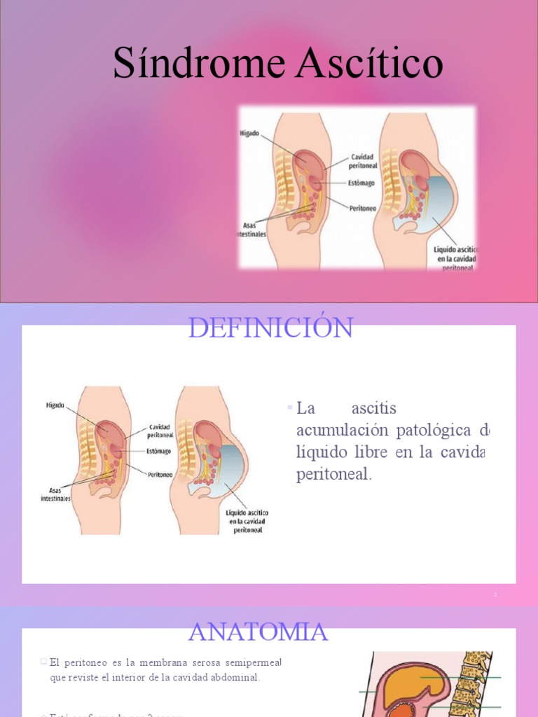 Causas y Tratamiento de Ascitis | PDF | Peritoneo | Abdomen