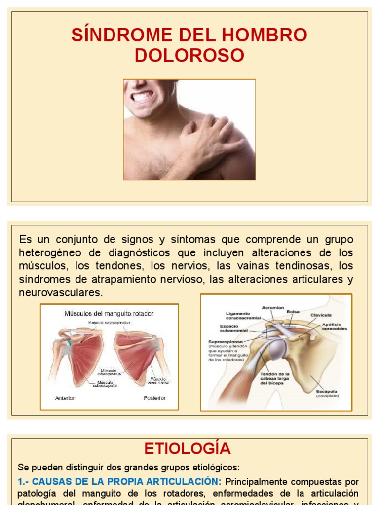 Síndrome Del Hombro Doloroso - PPTX Expo | PDF | Hombro | Medicina CLINICA