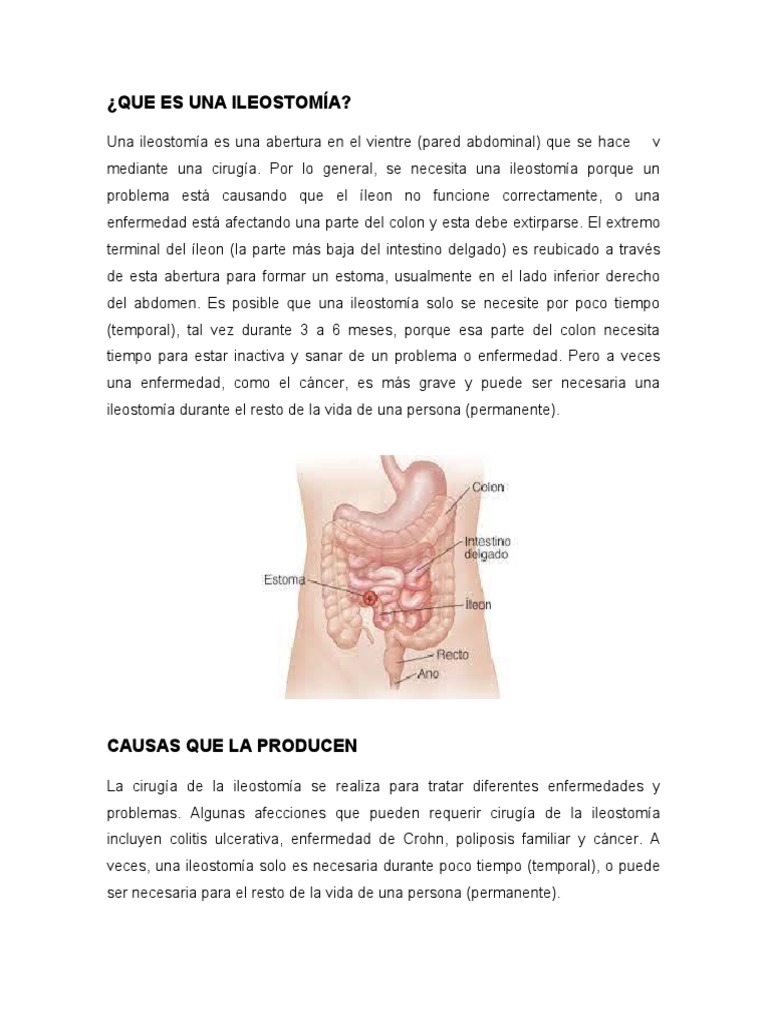 Que Es Una Ileostomía Info | PDF | Intestino grueso | Abdomen