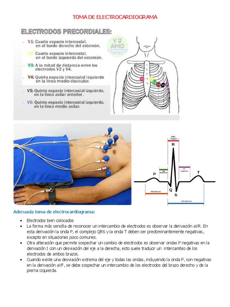 Toma de Ekg | PDF