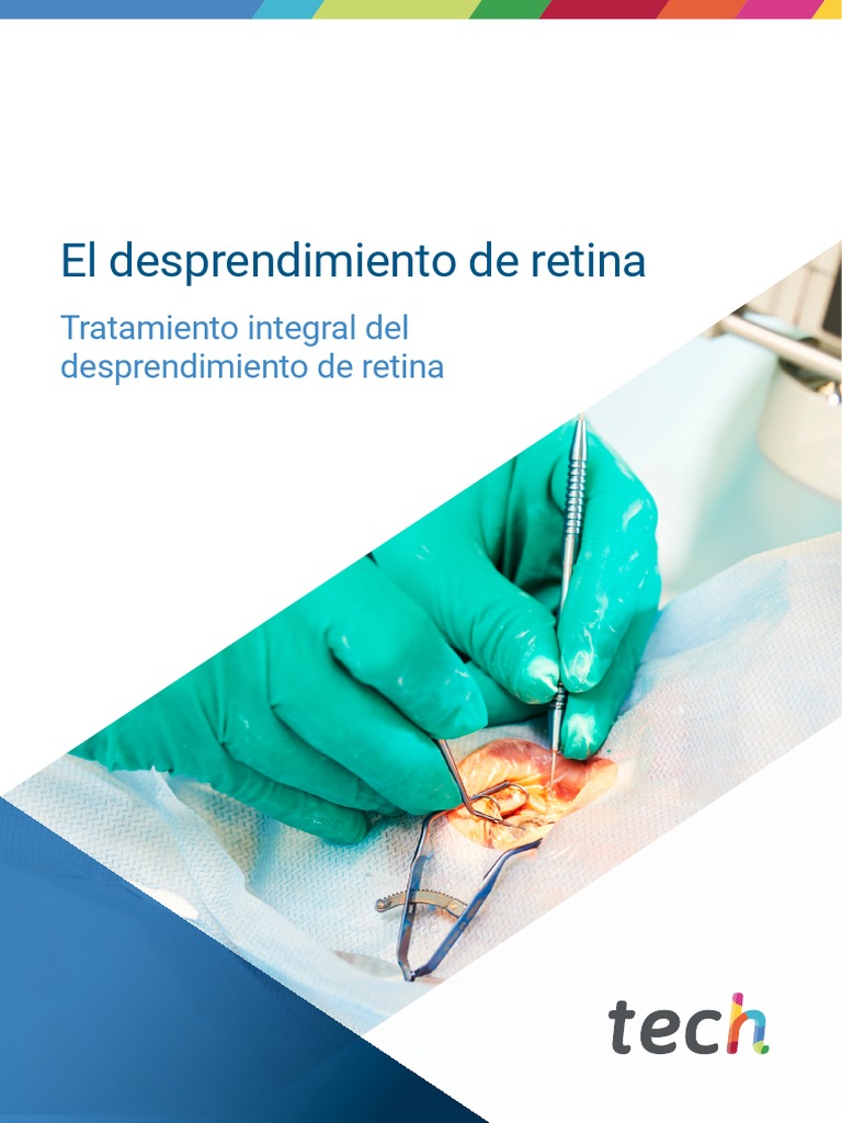 El Desprendimiento de Retina | PDF | Catarata | Visión