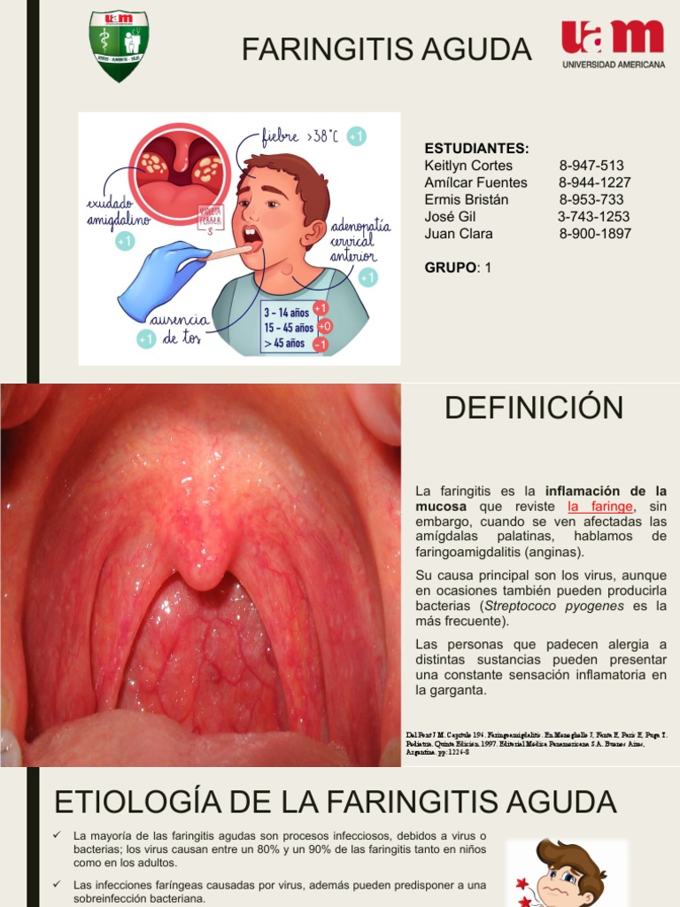 Faringitis Aguda | PDF | Virus | Resfriado comun