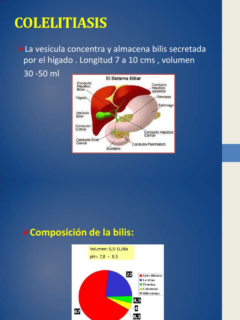 Litiasis Vesicular y Sus Complicaciones | PDF | Vesícula biliar ...