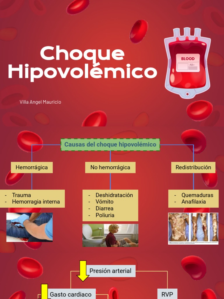Choque Hipovolémico | PDF | Causas de la muerte | Sistema cardiovascular