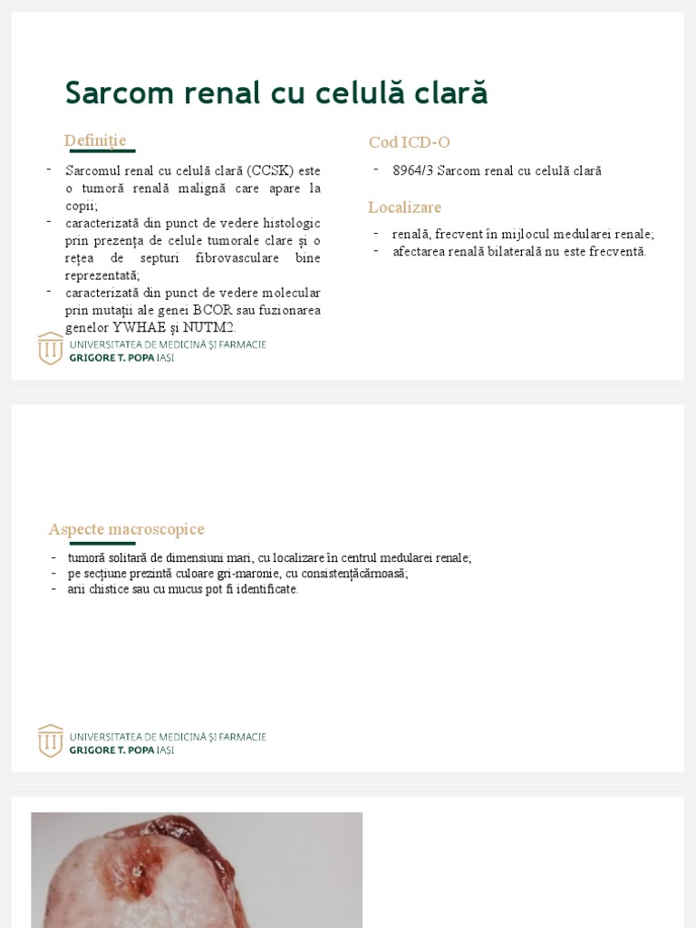 Sarcom Renal Cu Celulă Clară | PDF