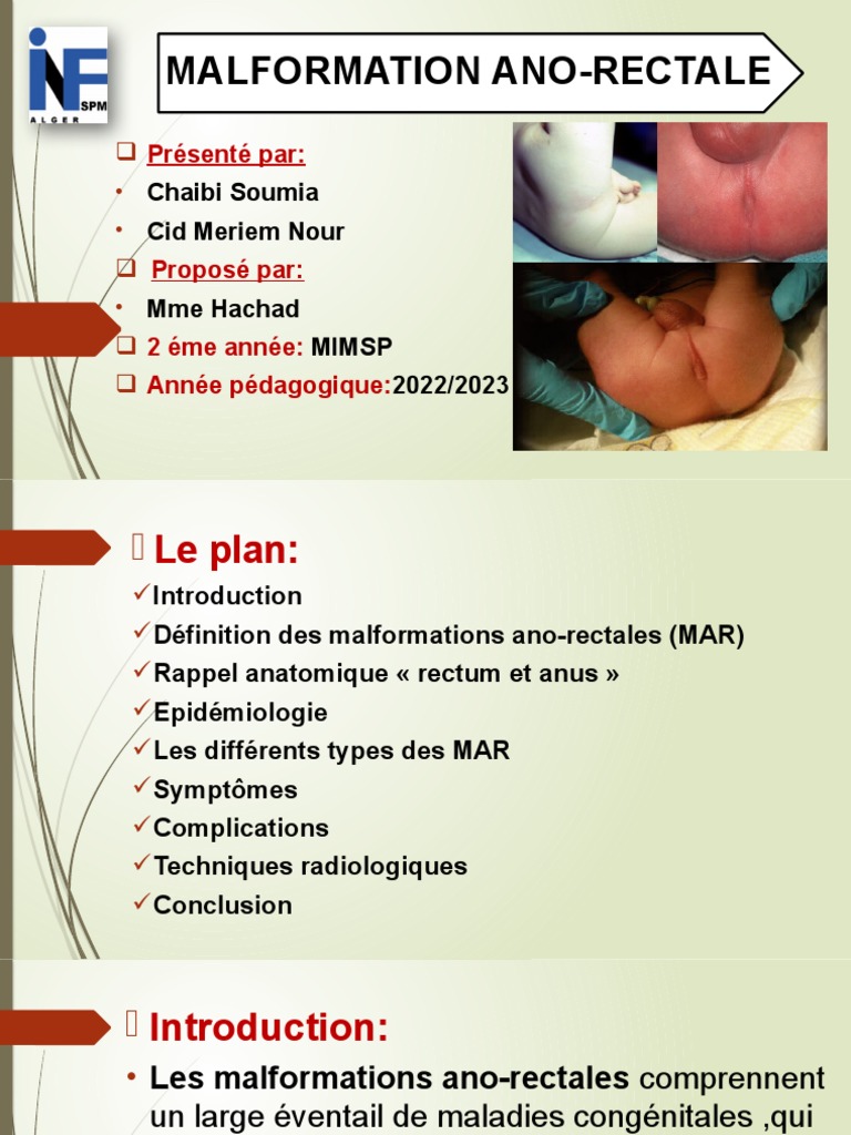 Malformation Ano Rectale | PDF | Rectum | Gastroentérologie