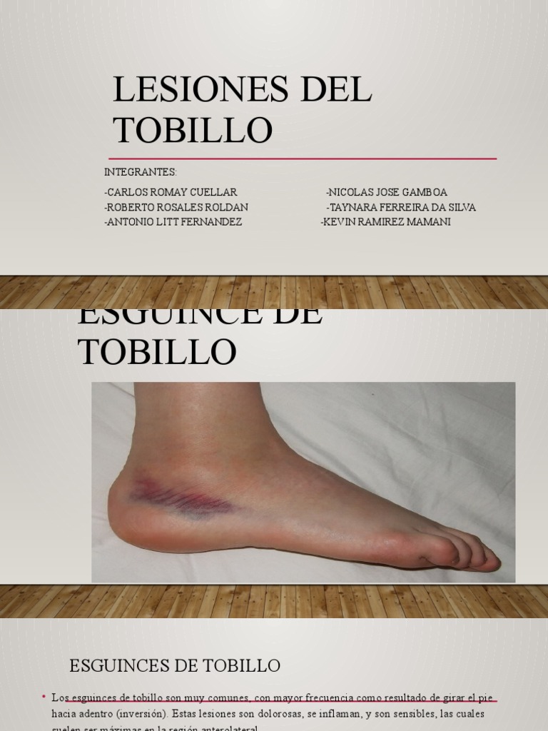 Lesiones Del Tobillo | PDF