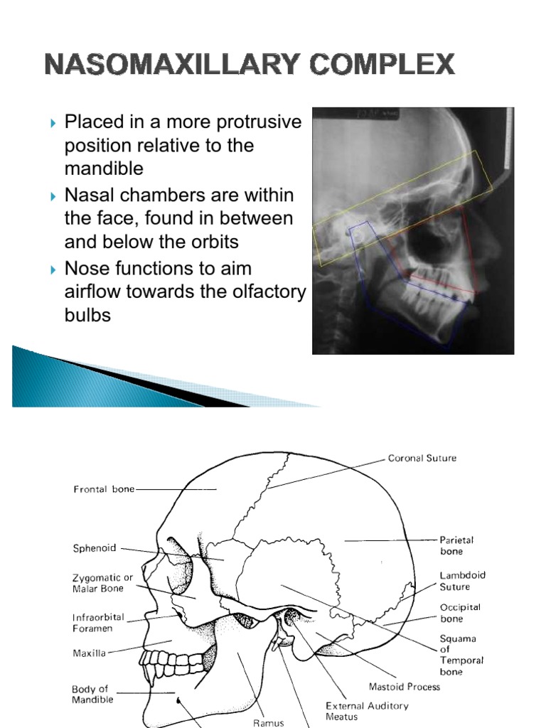 Nasomaxillary Complex