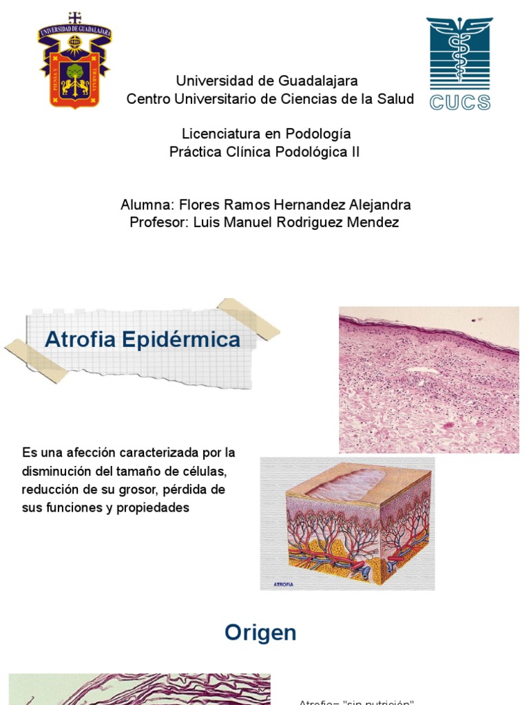 Atrofia Epidérmica | PDF | Atrofia | Medicina CLINICA