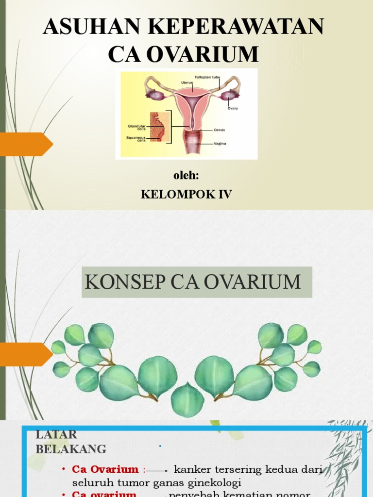 Kelompok 3 PPT Askep CA Ovarium | PDF
