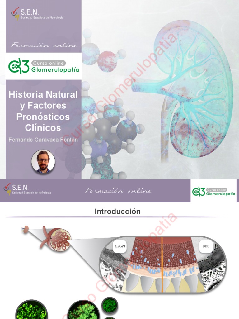 M2 T1 Glom | PDF | Mieloma múltiple | Sistema urinario