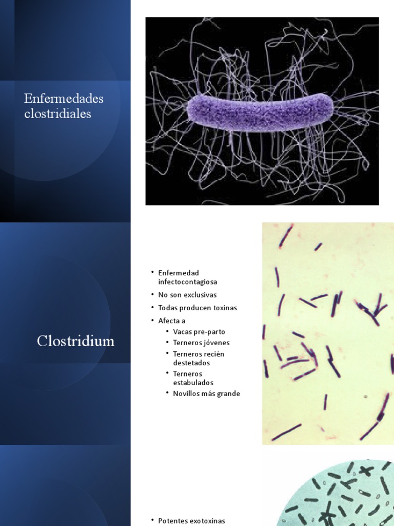 Enfermedades Clostridiales y Prion | PDF | Cerebro | Ciencias de la Salud