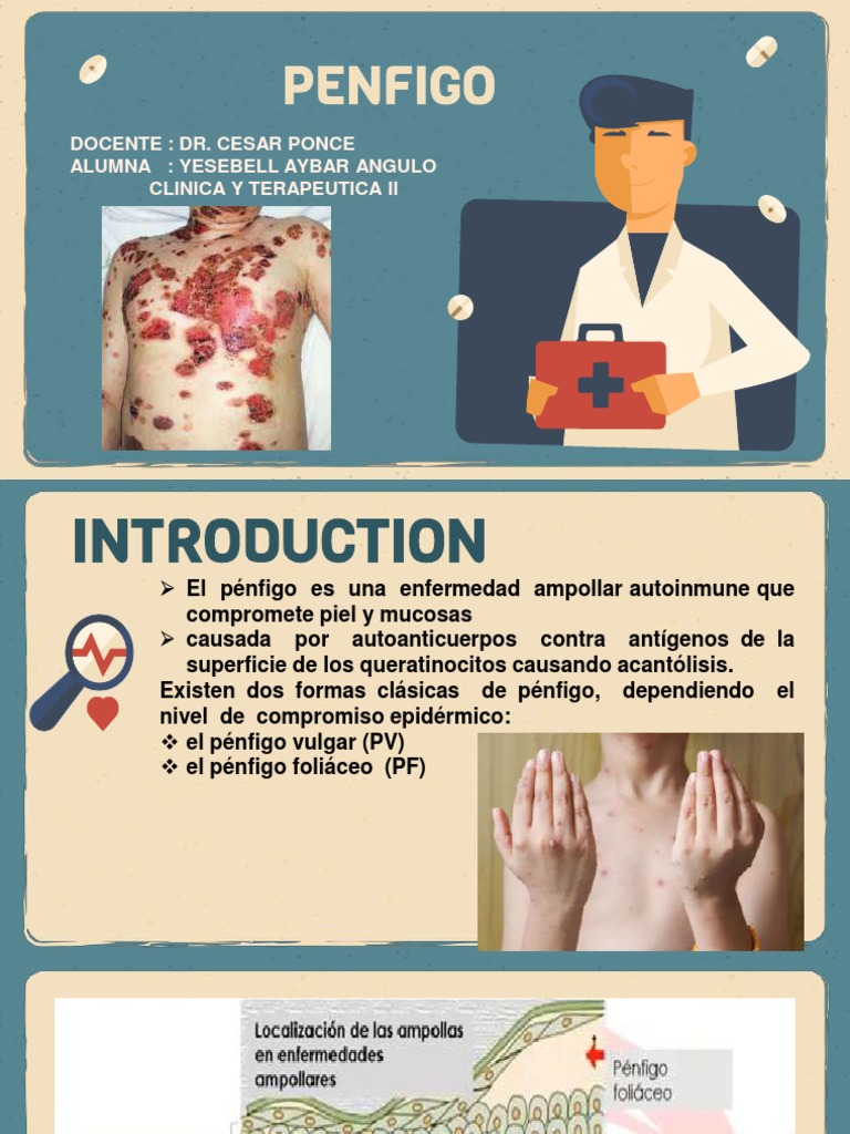 Penfigo | PDF | Inmunología | Enfermedades y trastornos humanos