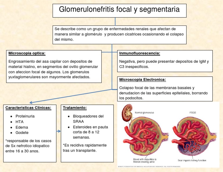 Glomerulonefritis Focal | PDF