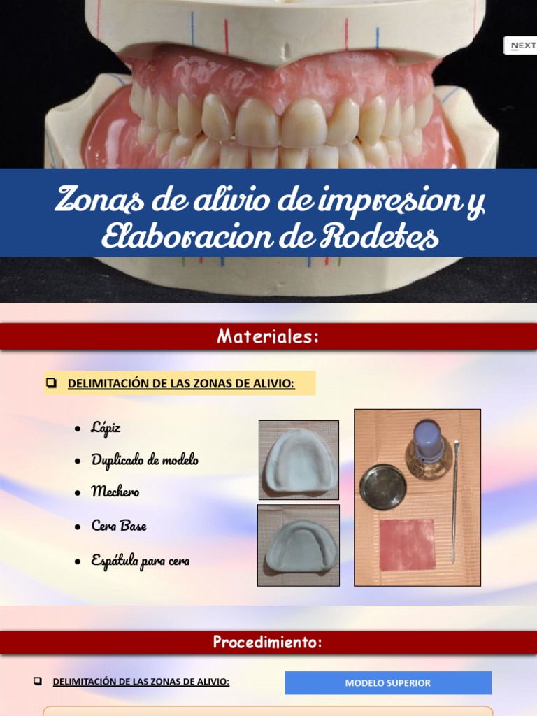 Elaboracion de Rodetes | PDF | Polimetacrilato de metilo) | Materiales