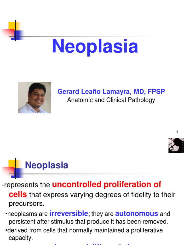Handout On Neoplasia | Download Free PDF | Metastasis | Cancer