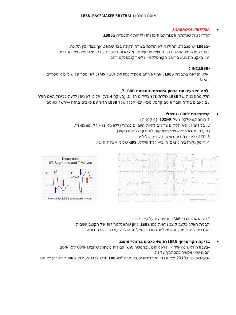 Ecg - Mi + LBBB - Pacing | PDF