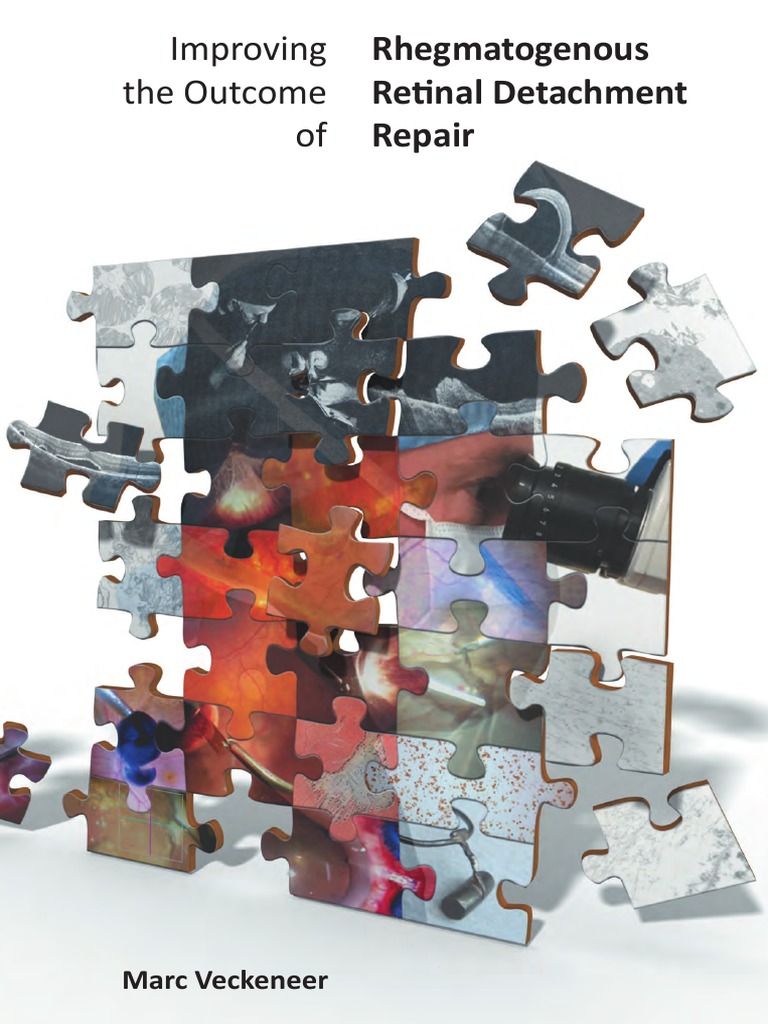Improving The Outcome of RRD Repair | PDF