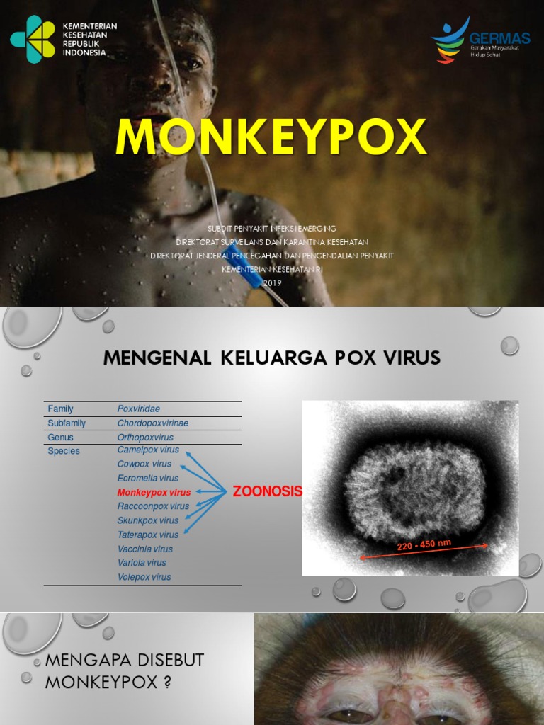 Monkeypox | PDF