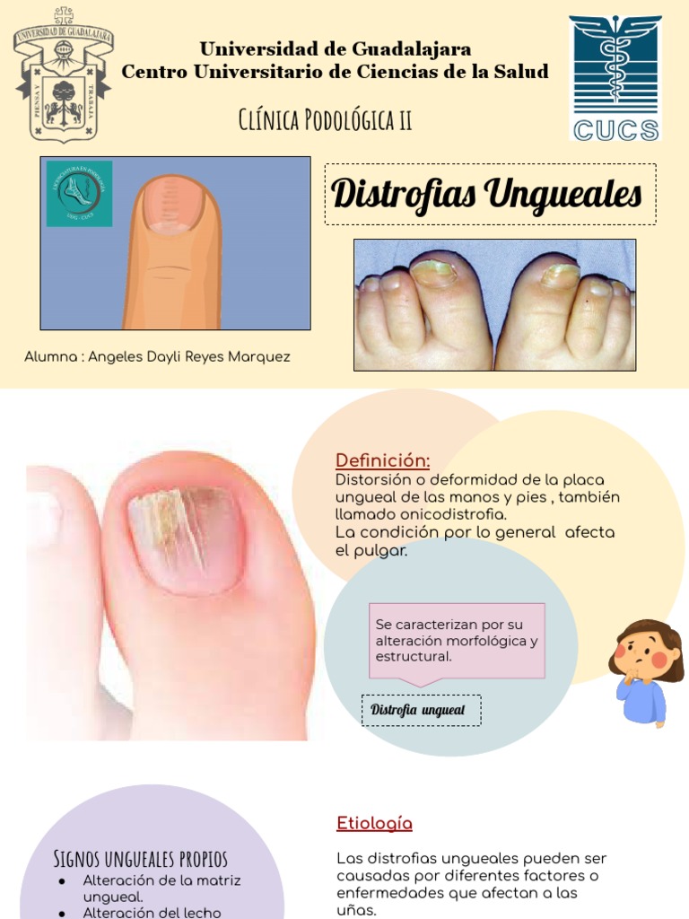 Distrofias Ungueales | PDF | Psoriasis | Clavo (anatomía)