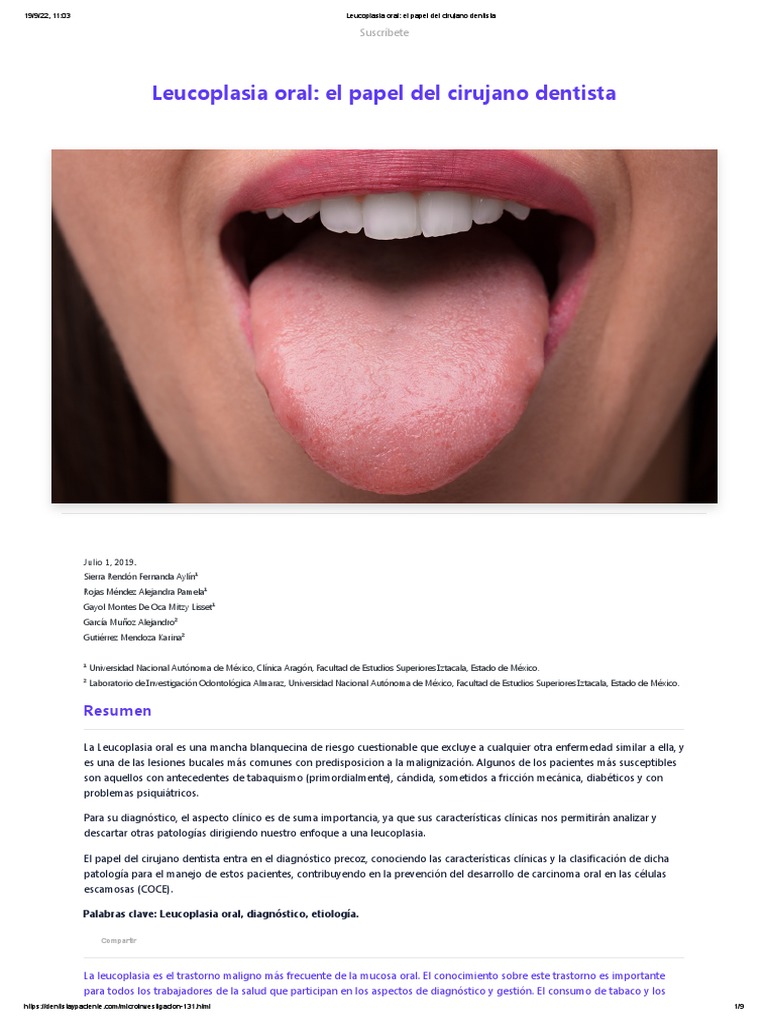 Leucoplasia Oral - El Papel Del Cirujano Dentista | PDF | Nicotina ...