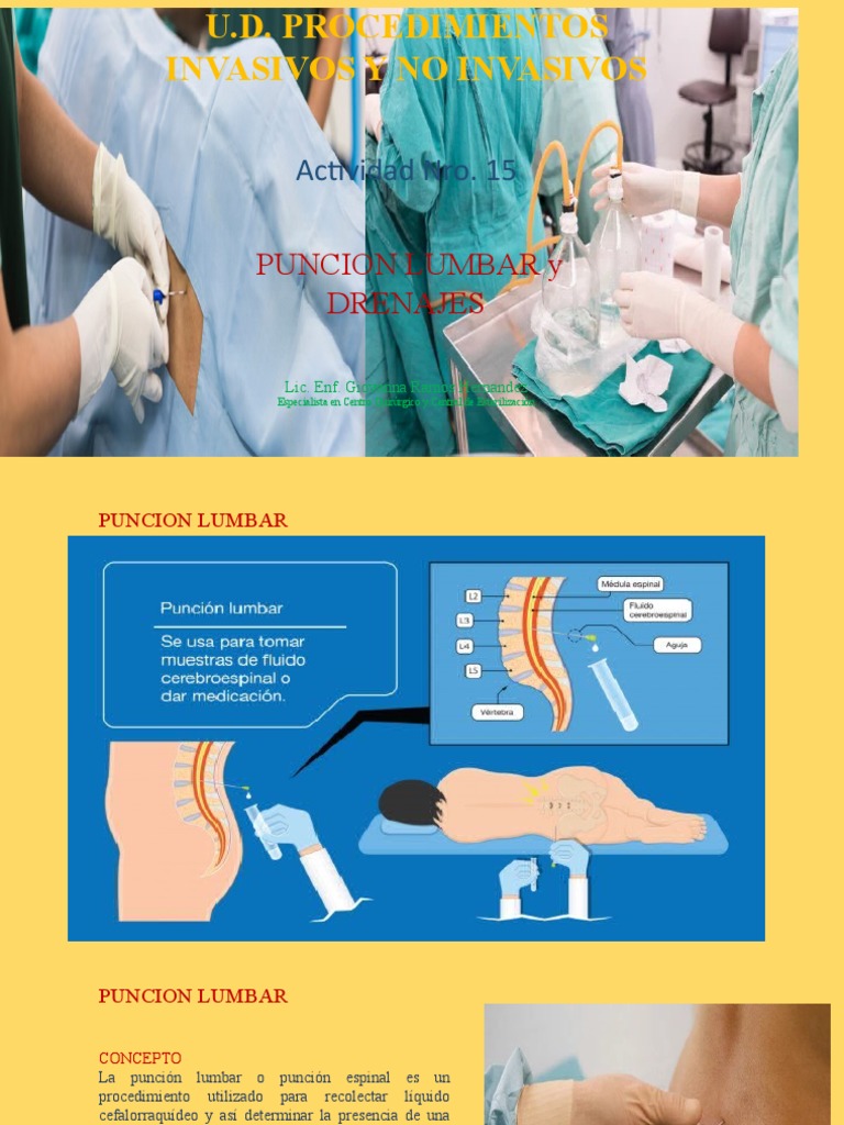 Paracentesis y Toracocentesis | PDF | Fluido cerebroespinal | Medicina ...