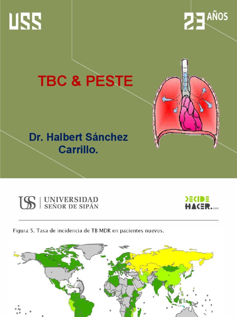 Clase 03. TBC Peste | PDF | Peste (enfermedad) | Tuberculosis