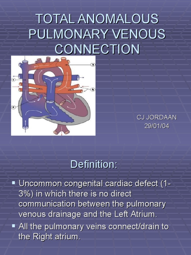Total Anomalous Pulmonary Venous Connection | PDF | Wellness