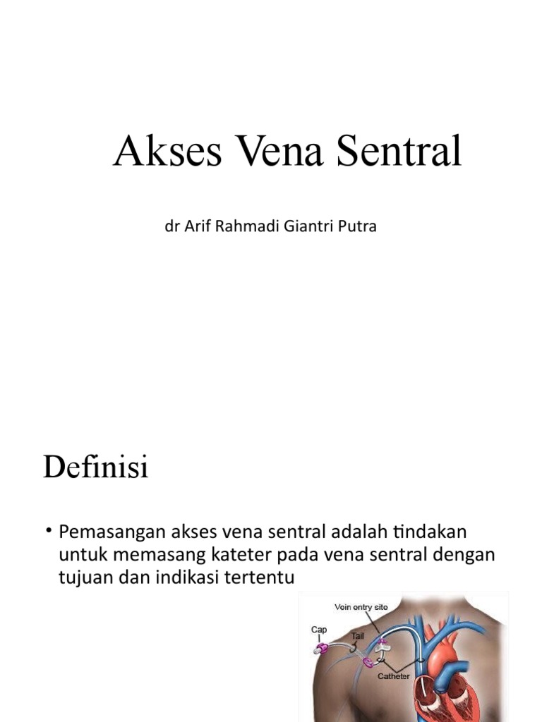 Akses Vena Sent-WPS Office | PDF