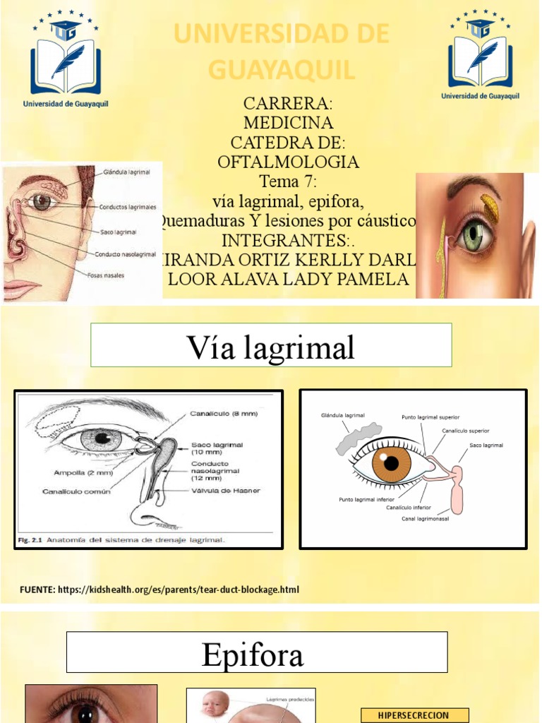 Tema 7-Via Lagrimal-Epifora-Quemaduras y Lesiones Por Causticos-. | PDF ...