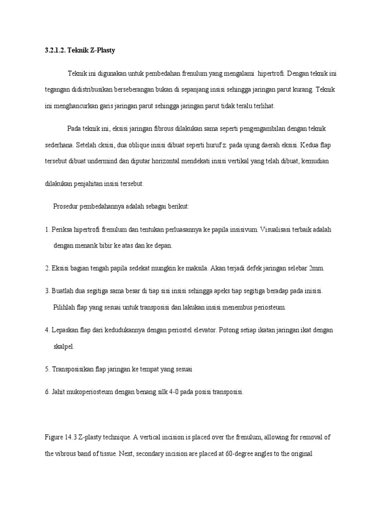 Ketik Frenectomy | PDF | Kesehatan Holistik | Sains & Matematika
