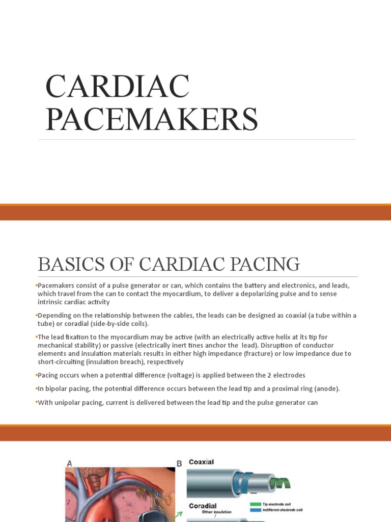 Pacemakers | PDF | Artificial Cardiac Pacemaker | Electrocardiography