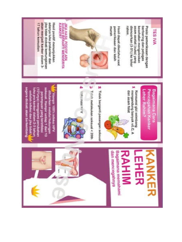 Leaflet Kanker Serviks | PDF