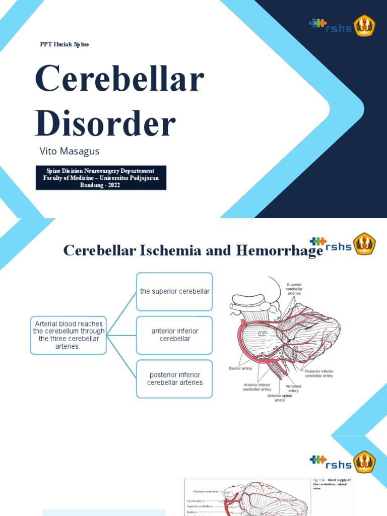Understanding Cerebellar Disorders: An In-Depth Look at Cerebellar ...