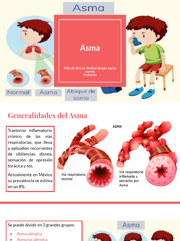 Generalidades del Asma en Pediatría | PDF | Asma | Alergia